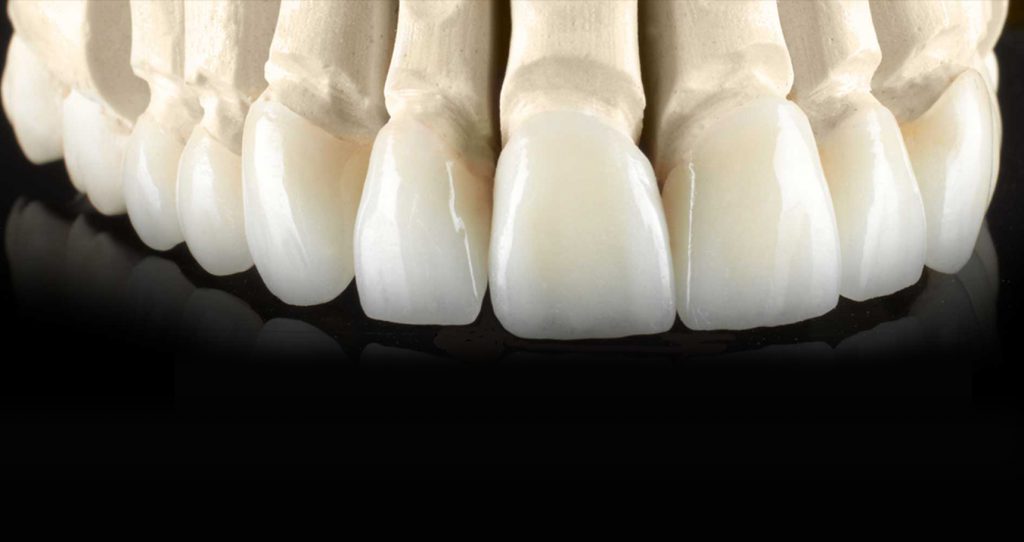 product-teeth - Hall Dental Studio